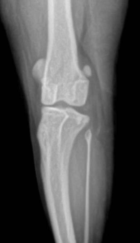Patellar Luxation (PLX) Patellar Luxation (PLX)